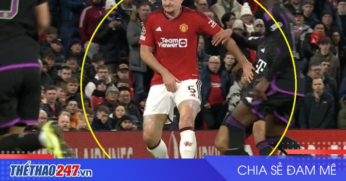 Harry Maguire dính chấn thương kỳ lạ, phải bỏ dở trận gặp Bayern